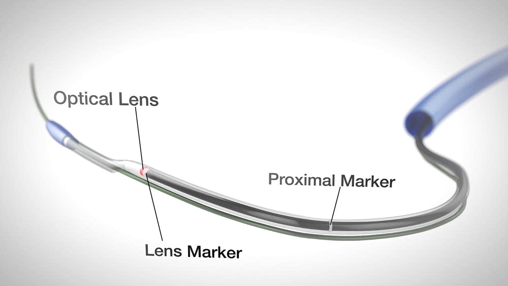 Optical tech for cardiology treatment expected to boost St. Jude ...