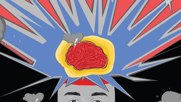 Too much AI in the office is causing "brain fry"