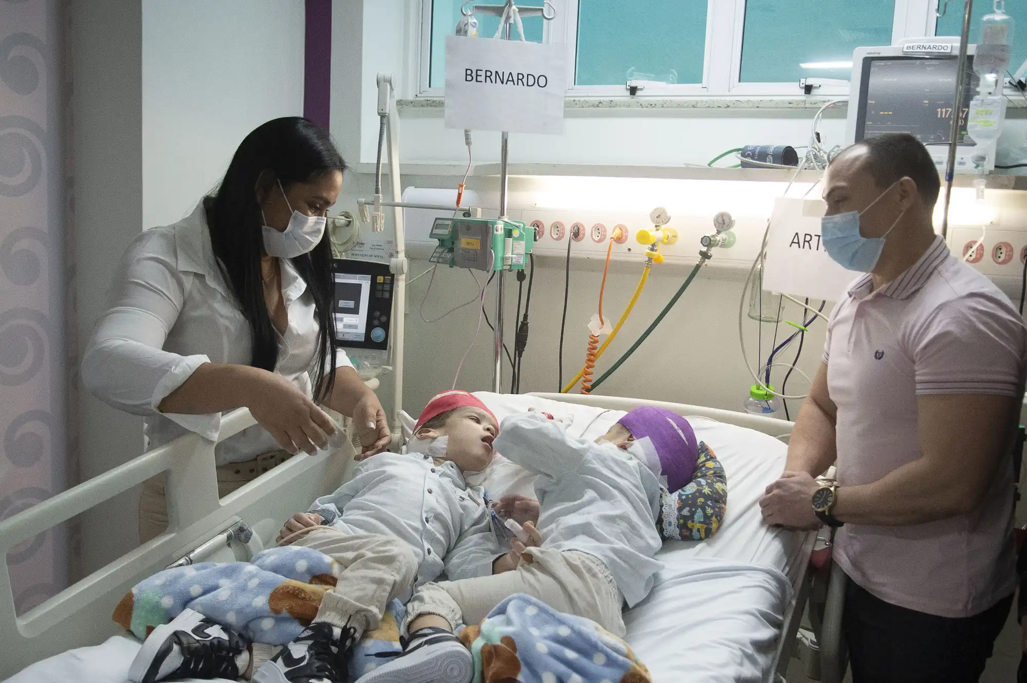 Surgeons on 2 continents use VR to prepare for conjoined twins ...