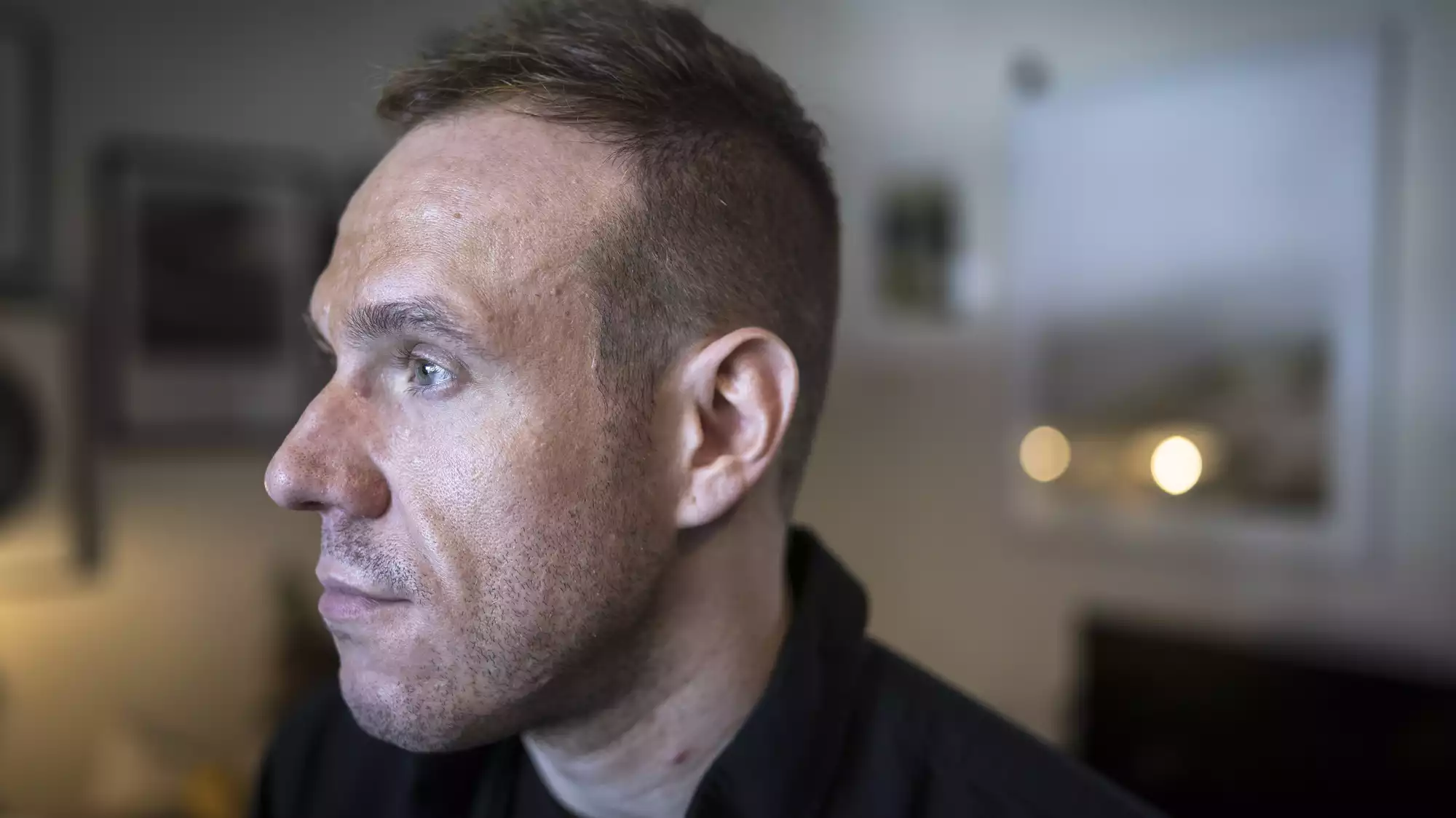 With monkeypox, stigma challenges Minnesota health response | MPR News