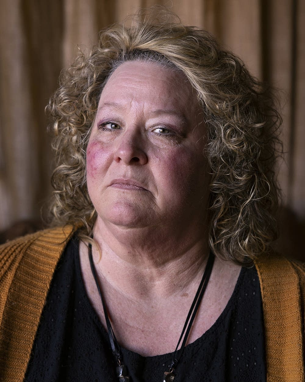 How Illinois’ sexual assault survivor law allows hospitals to deny care ...