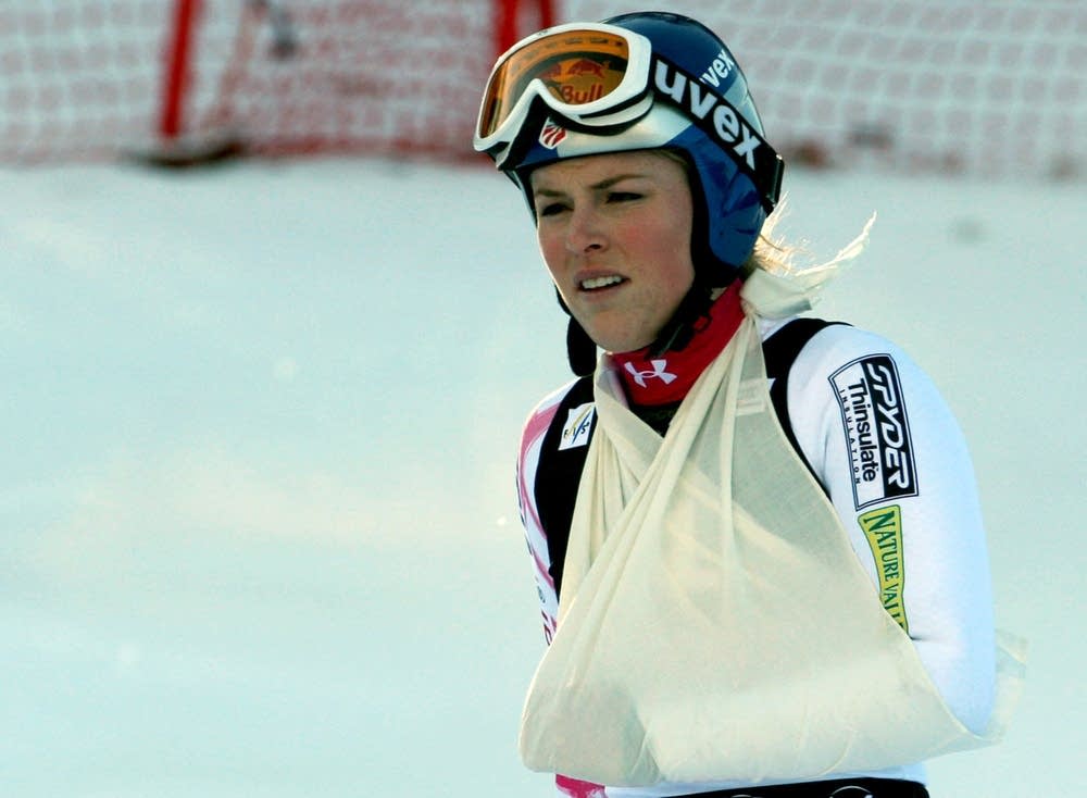 Vonn says injury may keep her out of Olympics | Minnesota Public Radio News