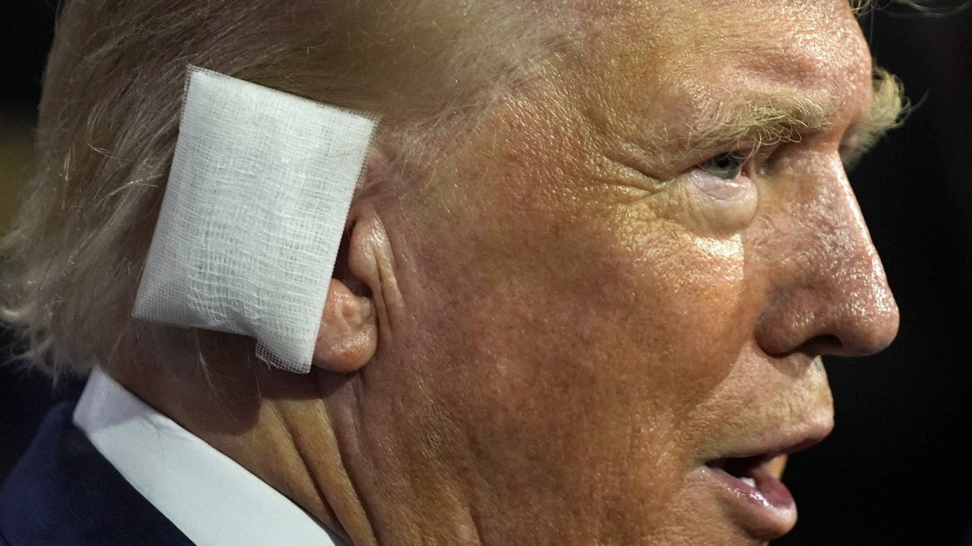 Trump enters Republican convention with a bandage covering his right ...