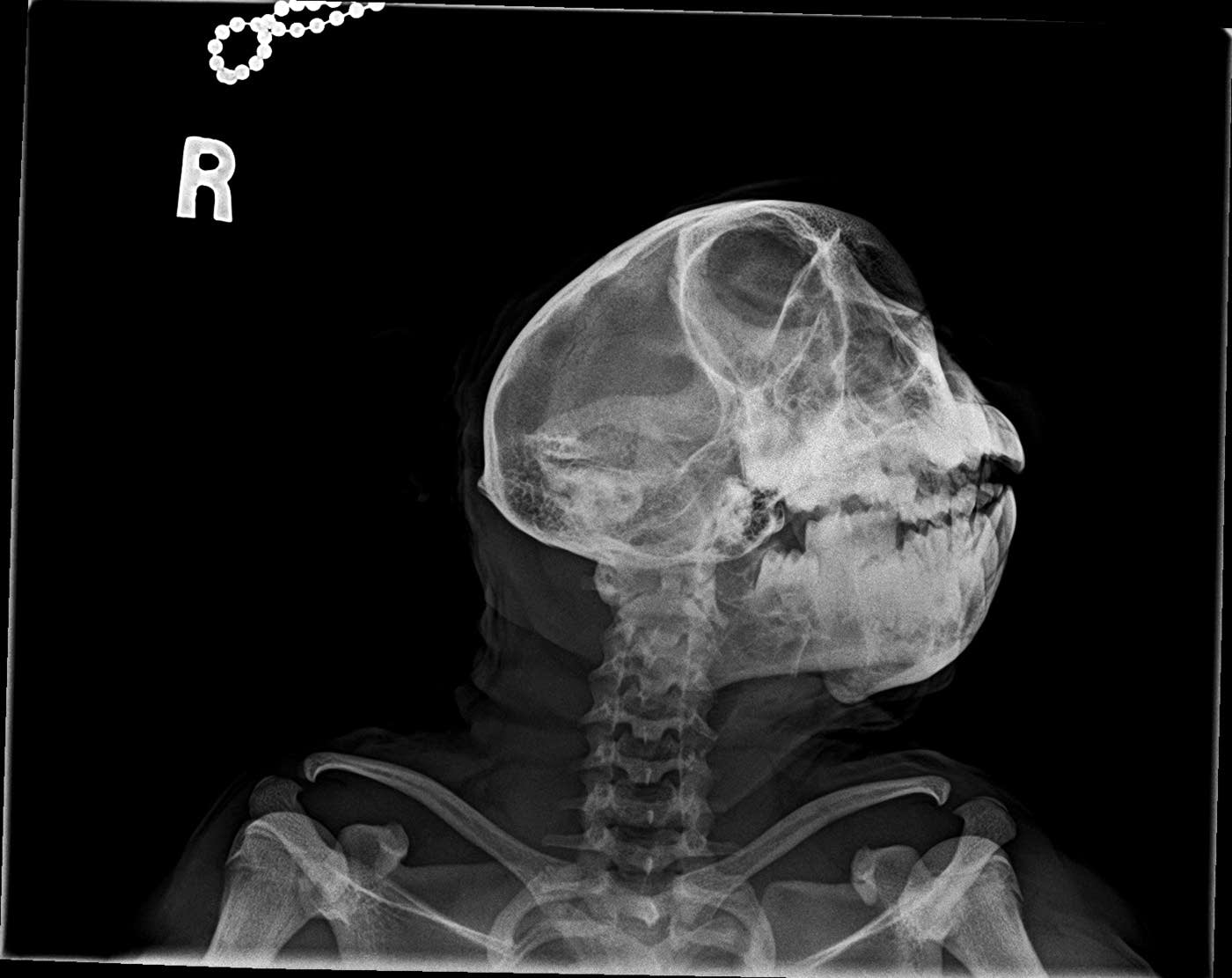 Odd, eerie and cool: Minnesota Zoo shares animal X-rays | MPR News