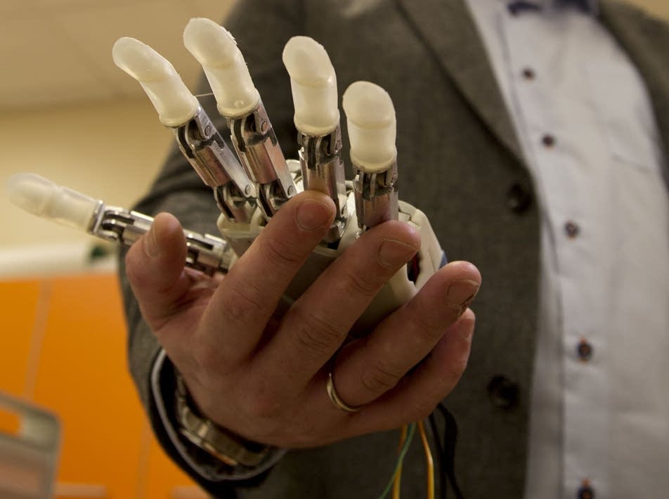 This artificial hand feels what you touch | MPR News