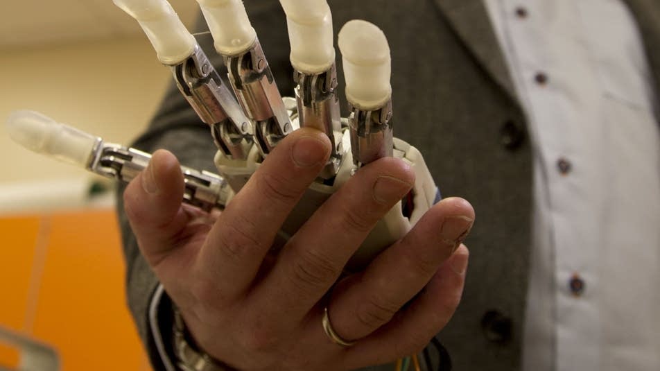 This artificial hand feels what you touch | MPR News
