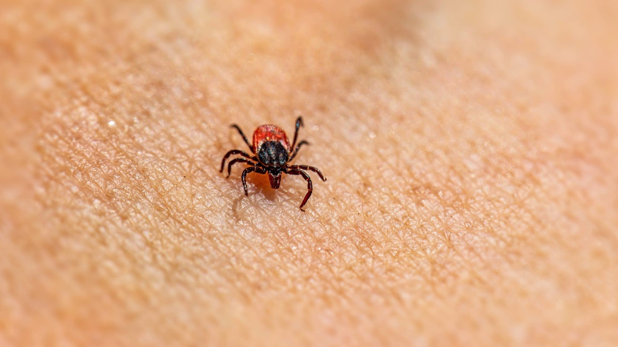 Warm weather brings ticks early to Minnesota | MPR News