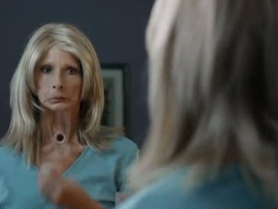 CDC launching graphic anti-smoking ad campaign | MPR News