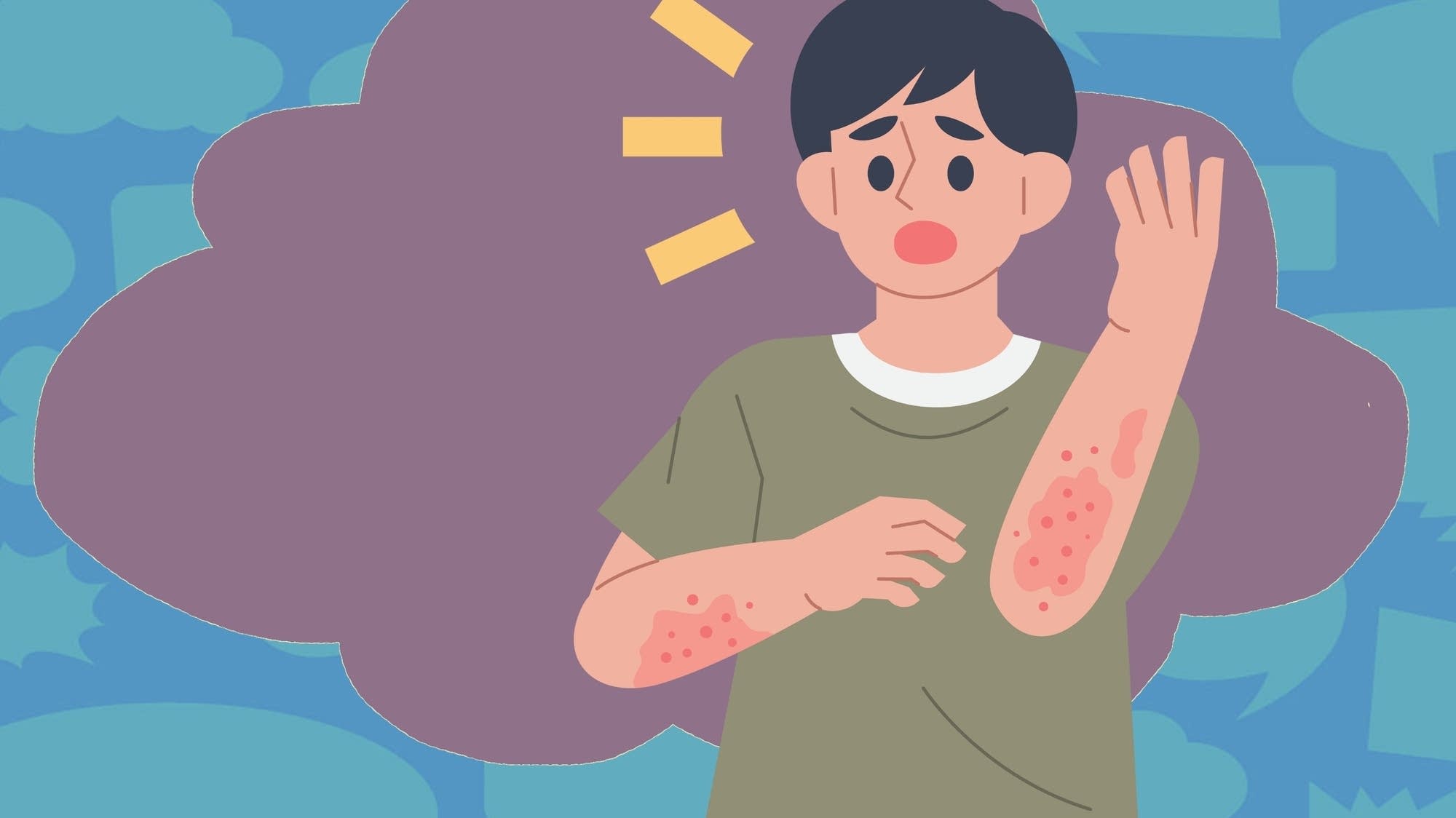 How does your skin make a rash? | Moment of Um