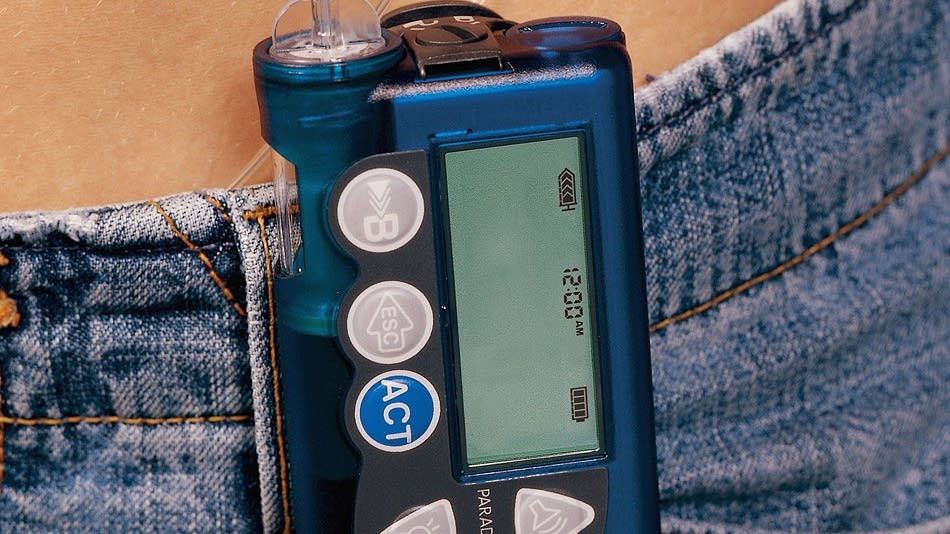 Consumer groups unhappy with bill easing medical device FDA review ...