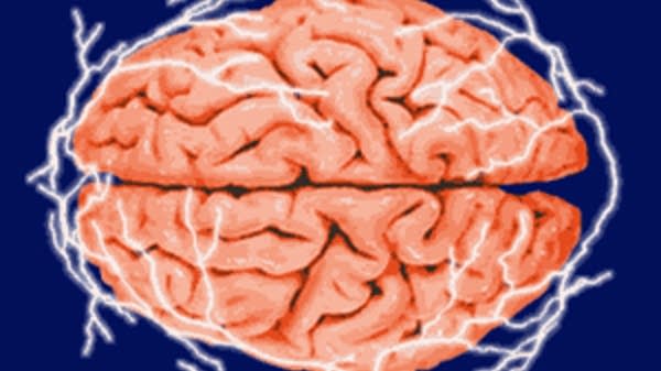 This is your brain on politics | MPR News